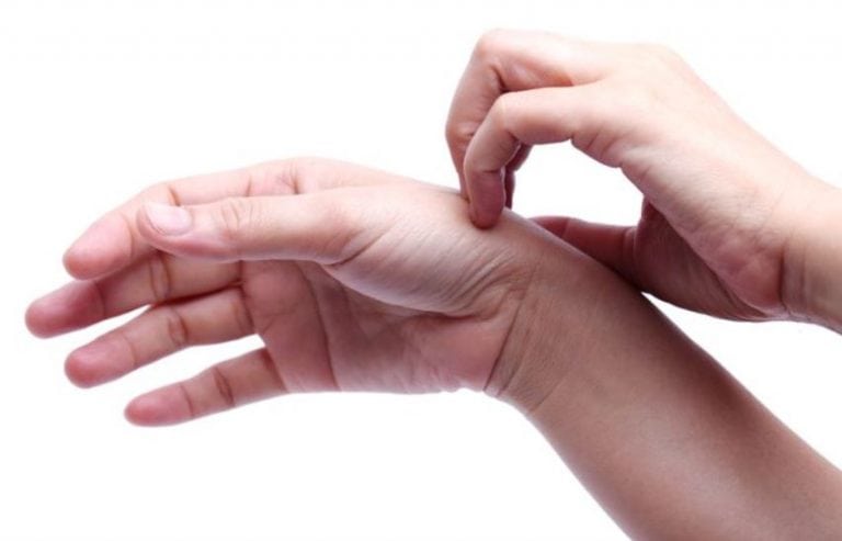 Why Itchy Hands: Dryness, Eczema, Psoriasis, Allergies? - Skincarederm